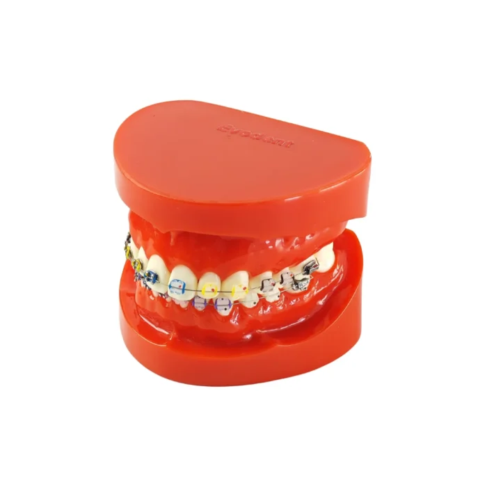 Buy Evodent Metal vs Ceramic Brackets Comparison Model for Patient ...