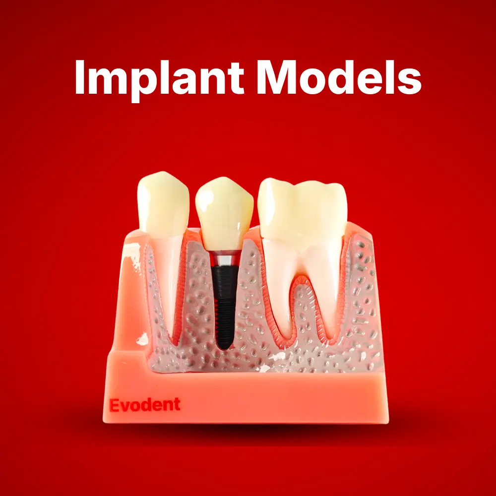 Buy Implant Models Online | Fast Delivery by Evodent